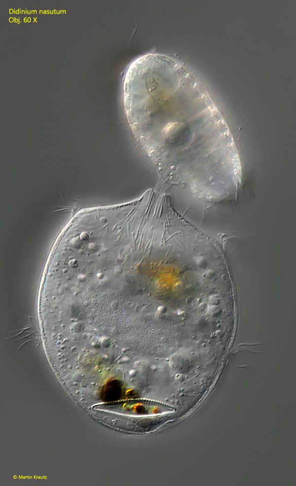 Didinium nasutum – Real Micro Life