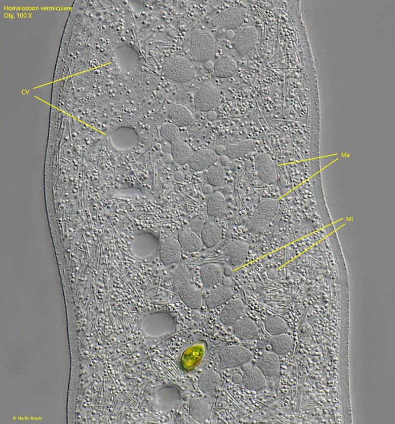 Homalozoon vermiculare – Real Micro Life