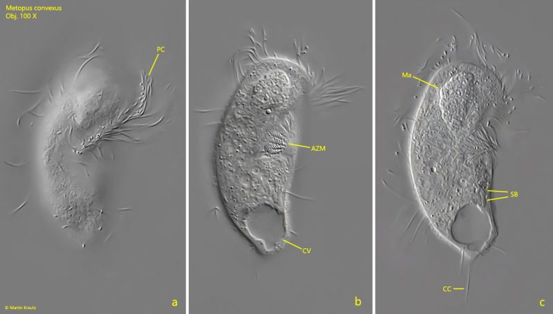 Metopus convexus – Real Micro Life