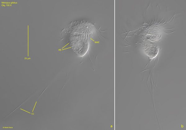 Metopus gibbus – Real Micro Life