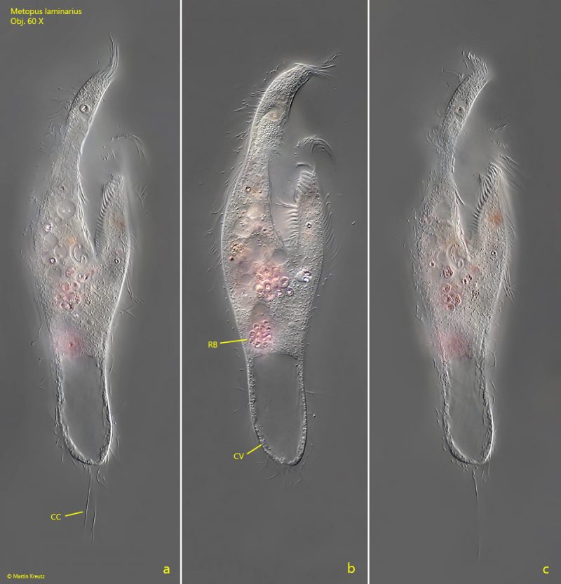Metopus laminarius – Real Micro Life
