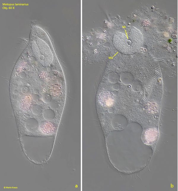 Metopus laminarius – Real Micro Life