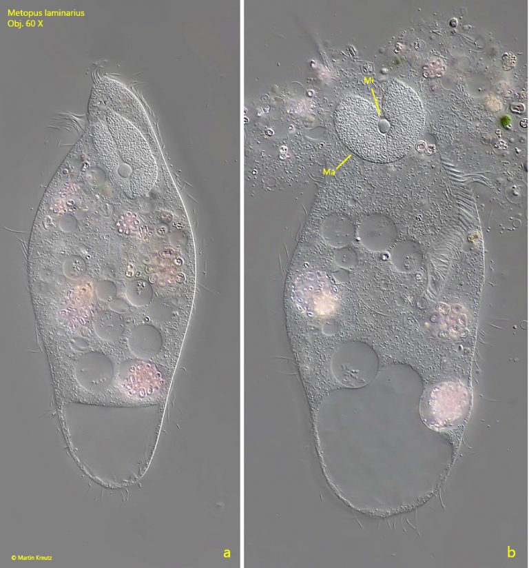 Metopus laminarius – Real Micro Life