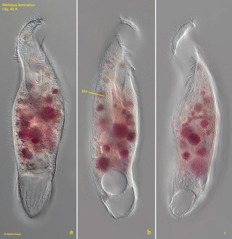 Metopus laminarius – Real Micro Life
