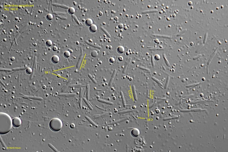 Legendrea pespelicani – Real Micro Life