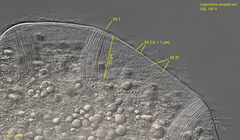 Legendrea pespelicani – Real Micro Life