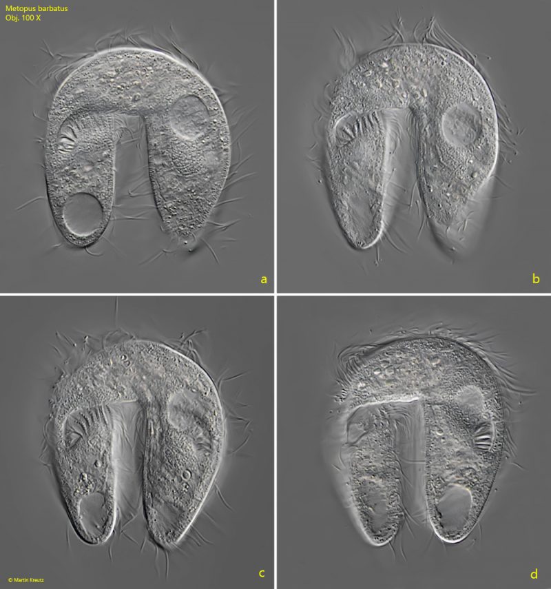 Metopus barbatus – Real Micro Life