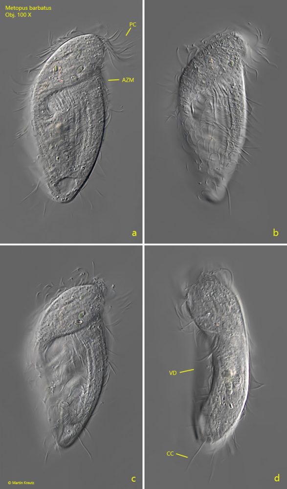 Metopus barbatus – Real Micro Life