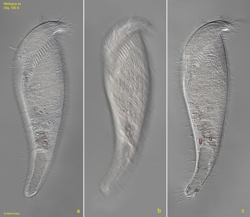 Metopus es – Real Micro Life