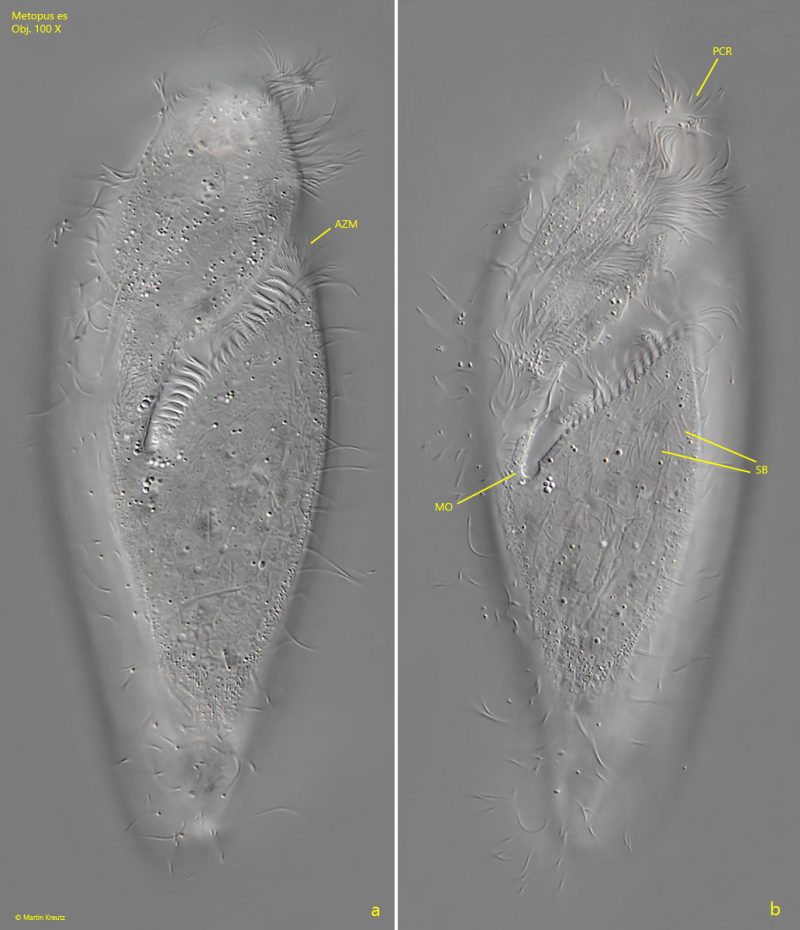 Metopus es – Real Micro Life