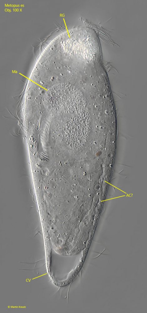 Metopus es – Real Micro Life