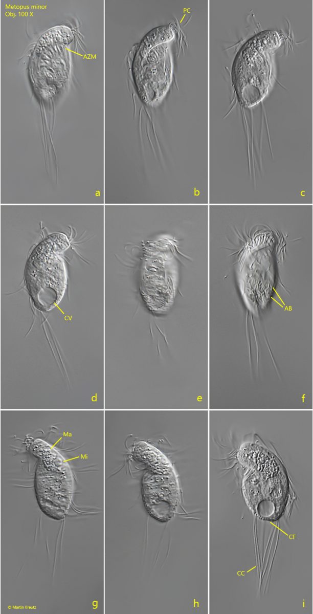 Metopus minor – Real Micro Life