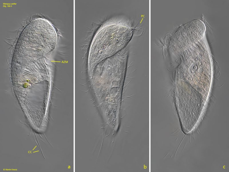 Metopus setifer – Real Micro Life