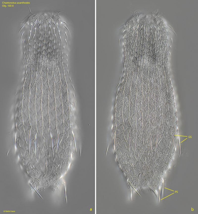 Chaetonotus acanthodes – Real Micro Life