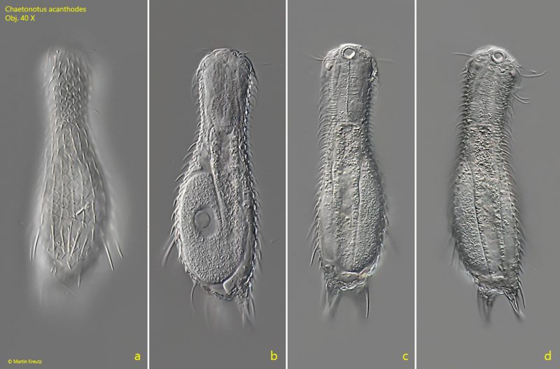Chaetonotus acanthodes – Real Micro Life