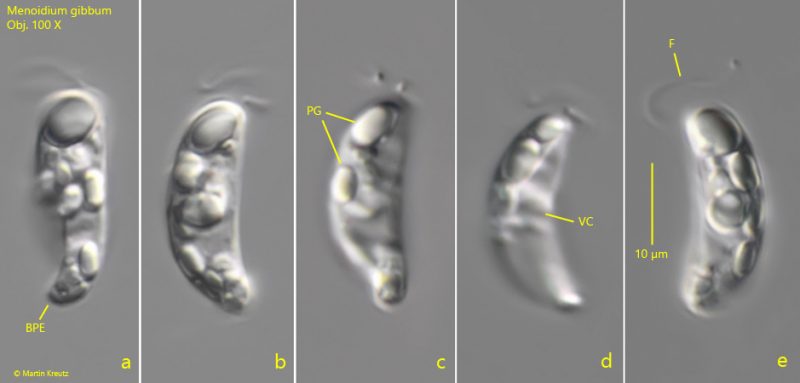 Menoidium gibbum – Real Micro Life