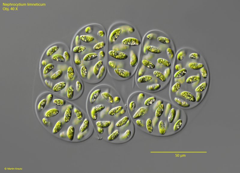 Nephrocytium limneticum – Real Micro Life