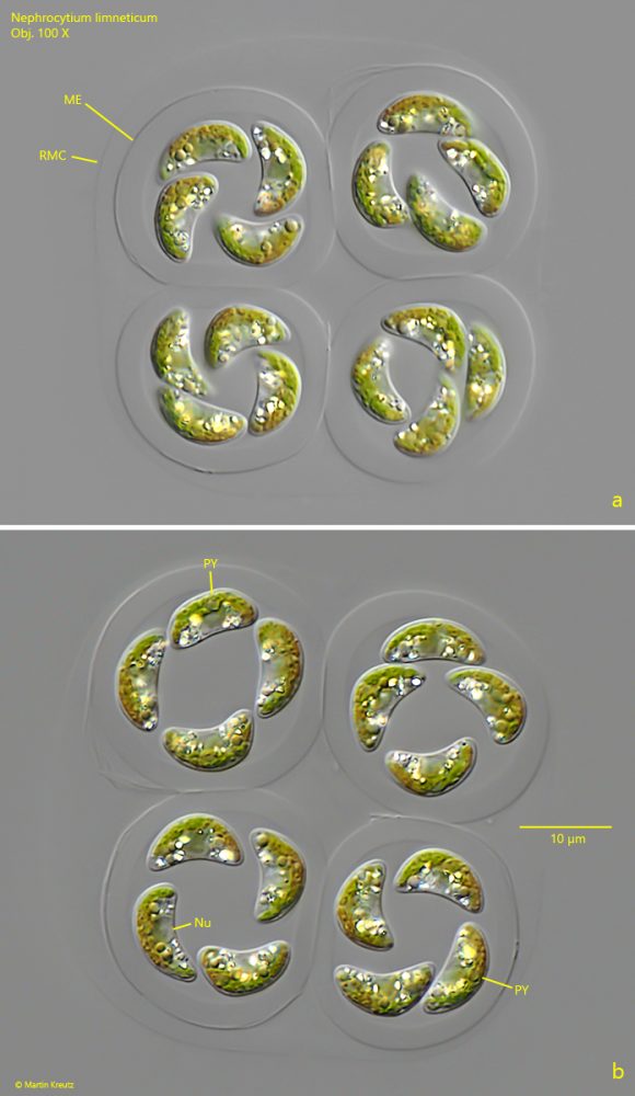 Nephrocytium limneticum – Real Micro Life