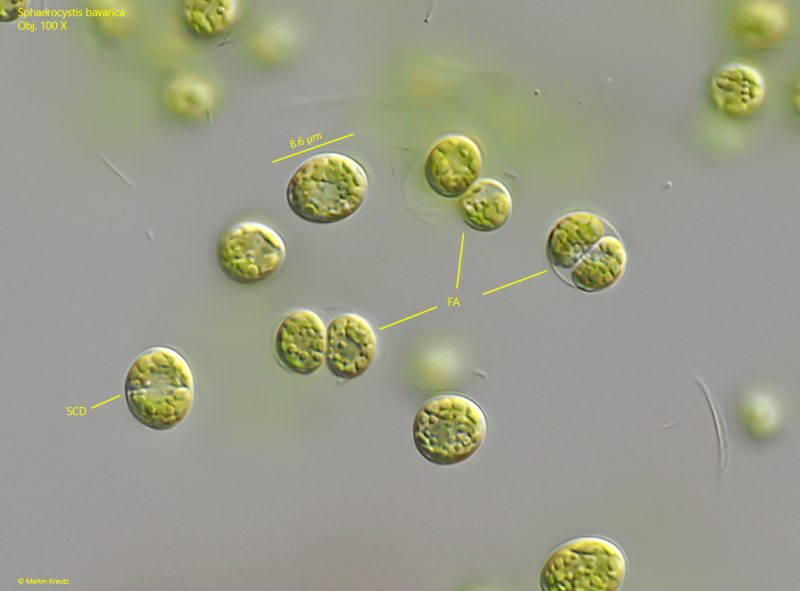 Sphaerocystis bavarica – Real Micro Life