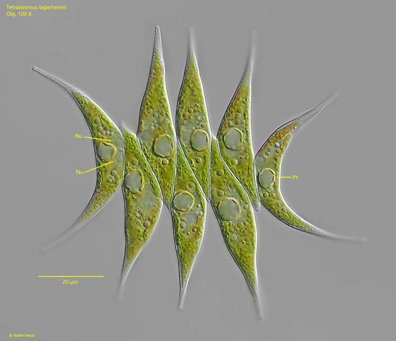 Tetradesmus lagerheimii – Real Micro Life