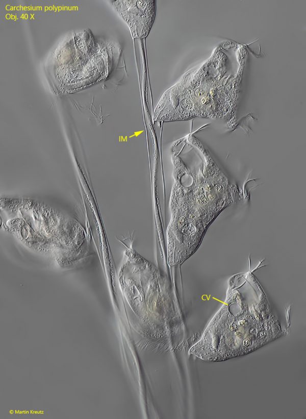 Carchesium polypinum – Real Micro Life