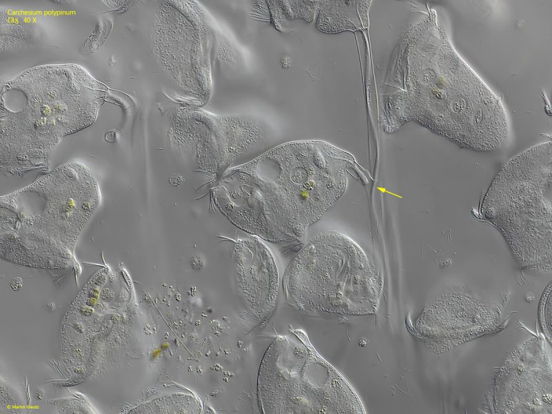 Carchesium polypinum – Real Micro Life
