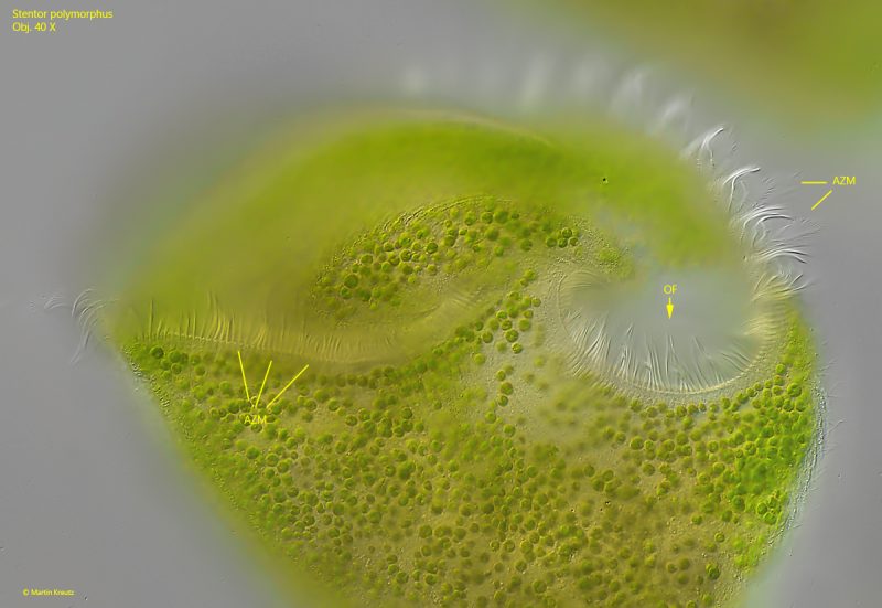 Stentor polymorphus – Real Micro Life