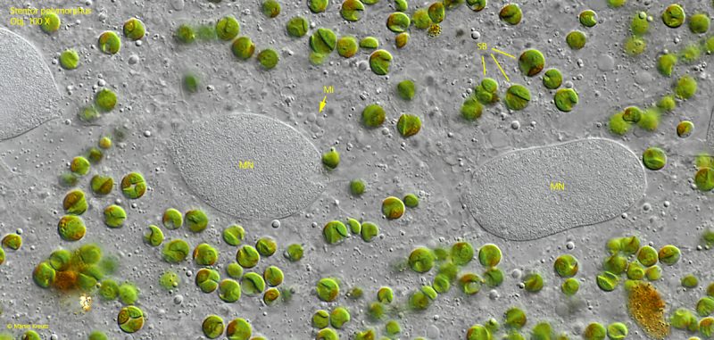 Stentor polymorphus – Real Micro Life