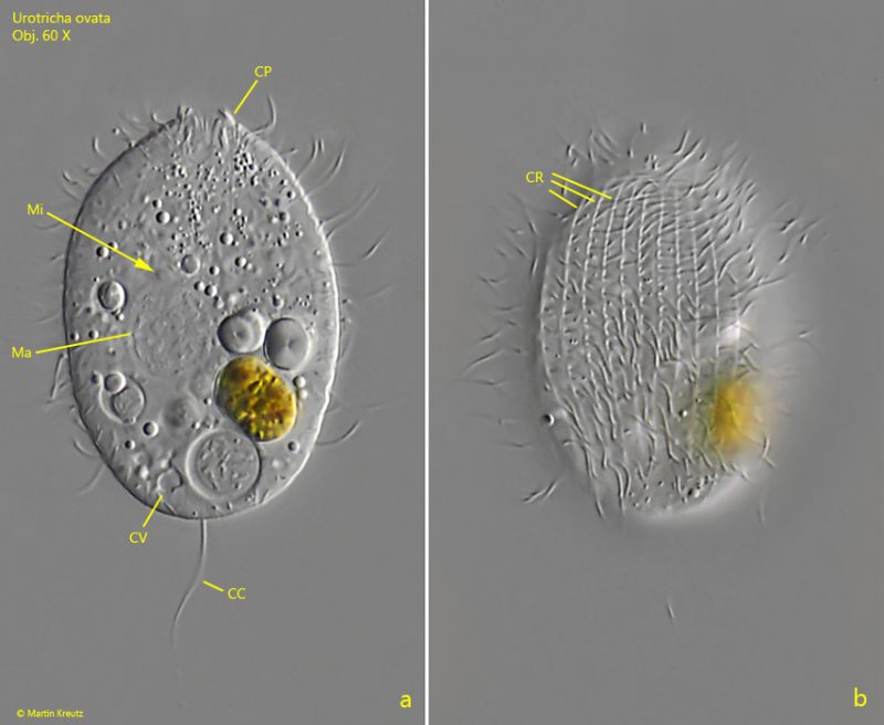 Urotricha ovata – Real Micro Life