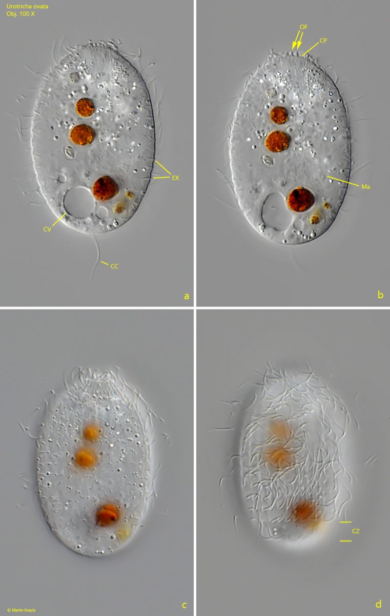 Urotricha ovata – Real Micro Life