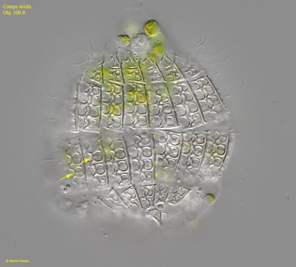 Coleps viridis – Real Micro Life