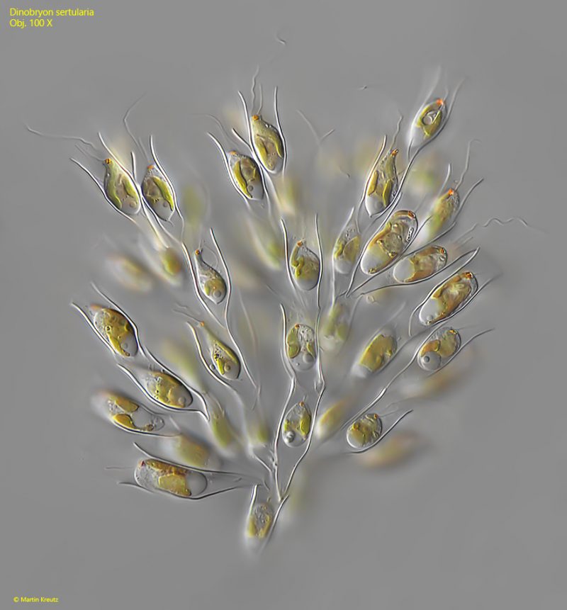 Dinobryon sertularia – Real Micro Life