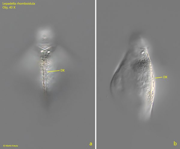 Lepadella rhomboidula – Real Micro Life