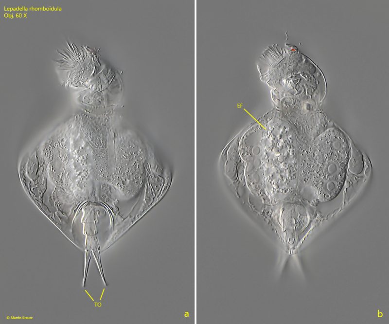 Lepadella rhomboidula – Real Micro Life