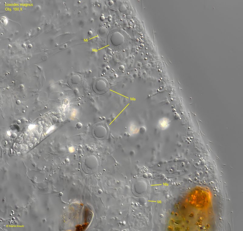 Loxodes magnus – Real Micro Life