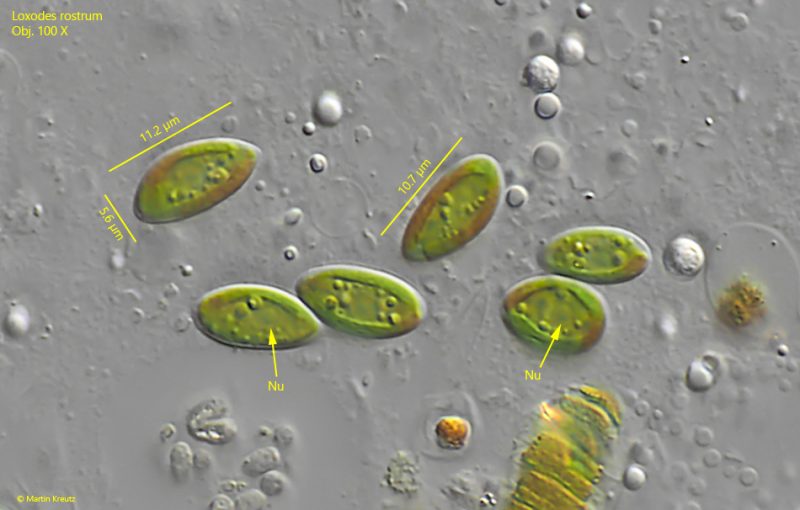 Loxodes rostrum – Real Micro Life