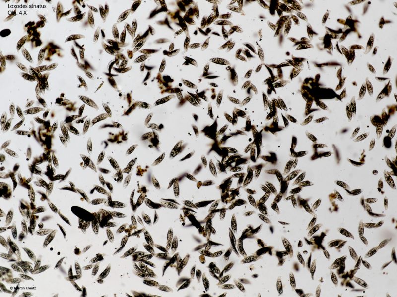 Loxodes striatus – Real Micro Life