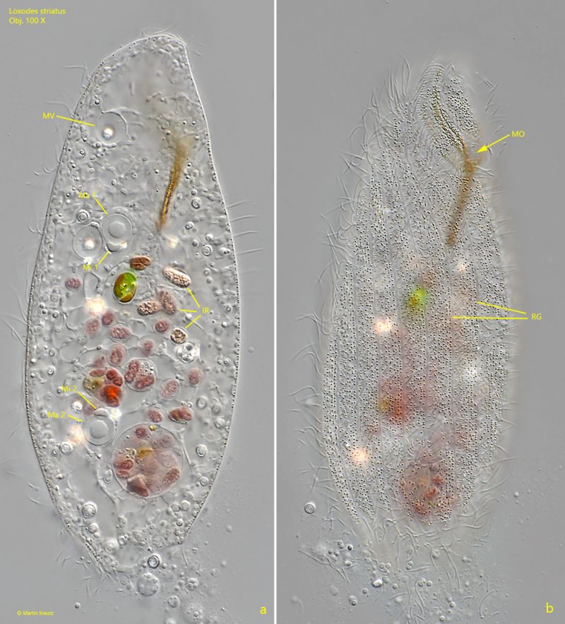 Loxodes striatus – Real Micro Life