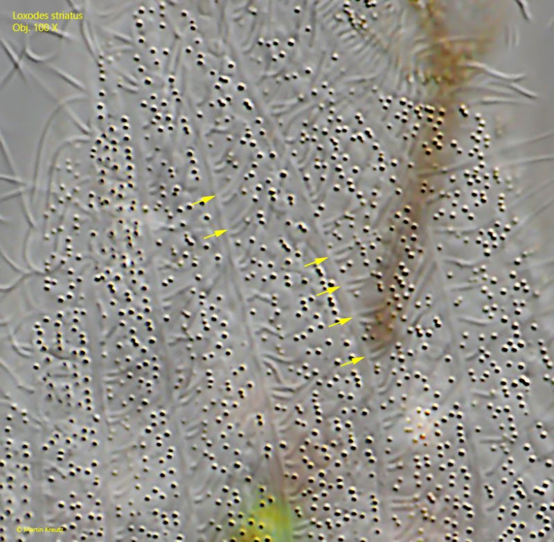 Loxodes striatus – Real Micro Life