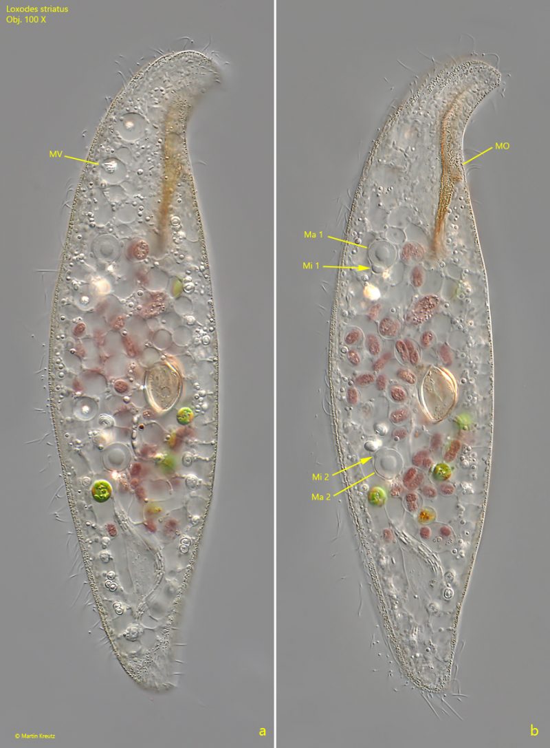 Loxodes striatus – Real Micro Life