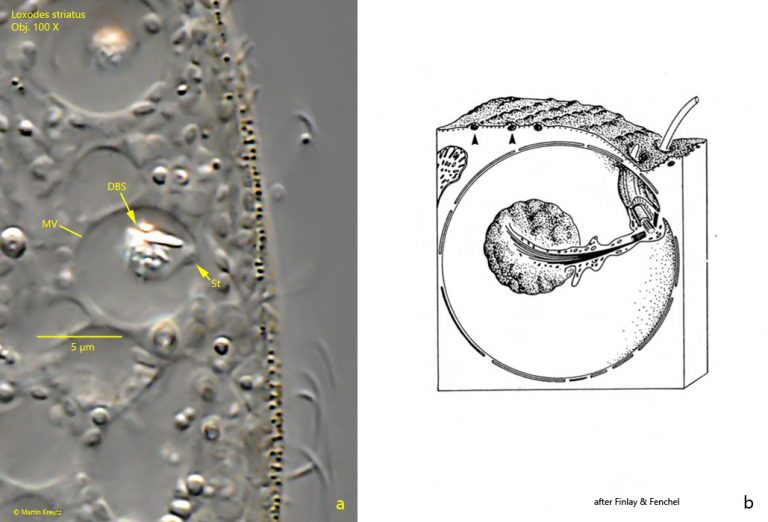 Loxodes striatus – Real Micro Life