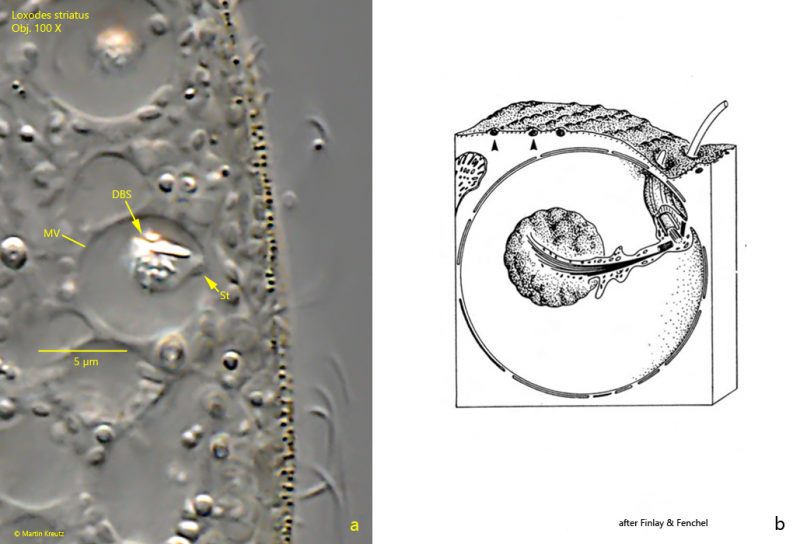Loxodes striatus – Real Micro Life
