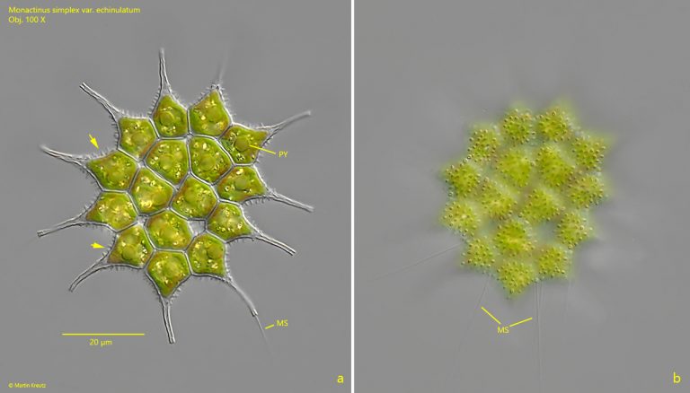 Monactinus simplex var. echinulatum – Real Micro Life