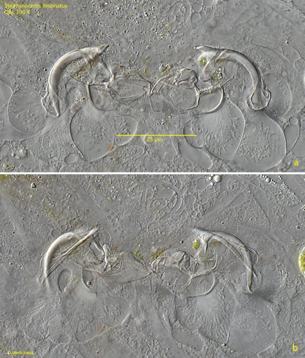 Stephanoceros fimbriatus – Real Micro Life