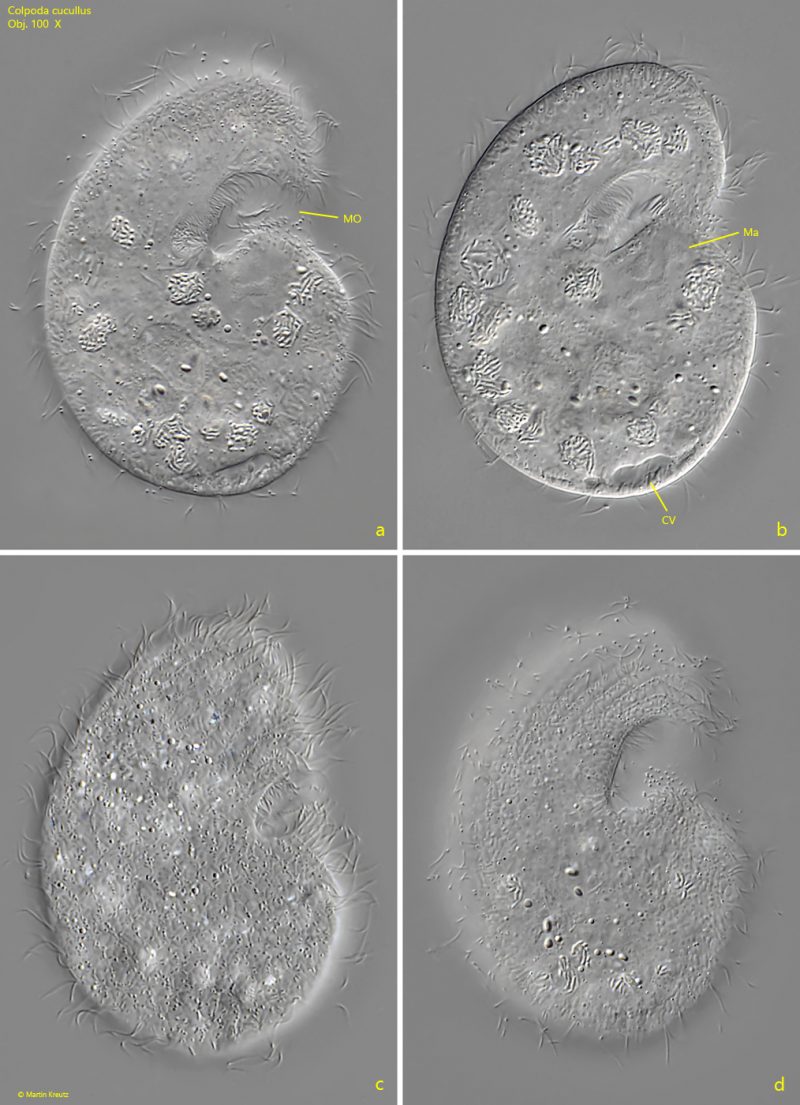 Colpoda cucullus – Real Micro Life