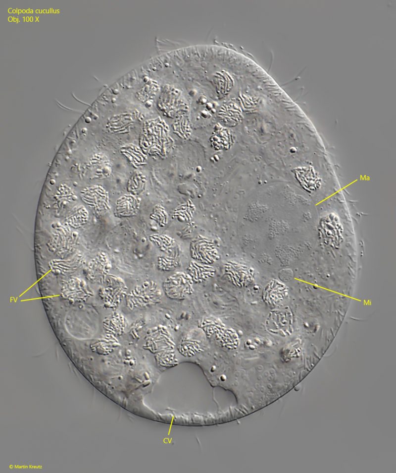 Colpoda cucullus – Real Micro Life