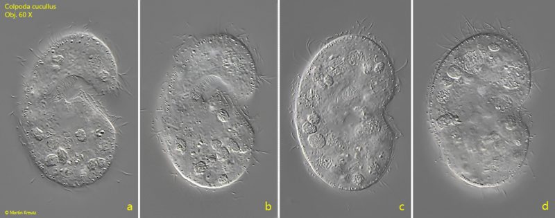 Colpoda cucullus – Real Micro Life