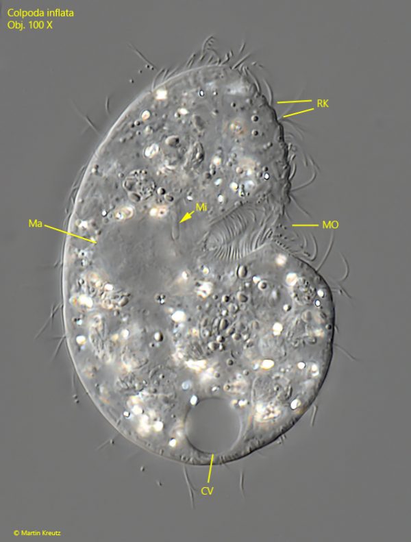 Colpoda inflata – Real Micro Life
