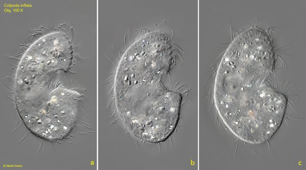 Colpoda inflata – Real Micro Life