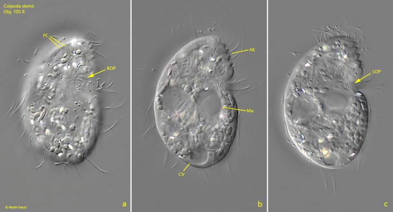Colpoda steinii – Real Micro Life